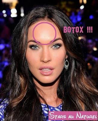 Megan Fox est farcie de botox ! - À Lire